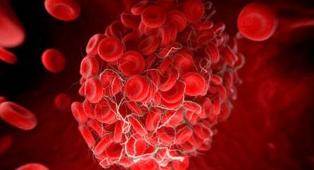 Produits | Neapolis Pharma - Médicaments génériques anticancéreux